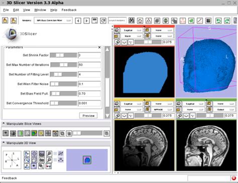 modules mribiasfieldcorrection documentation 3 5 slicer wiki