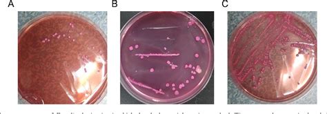 Figure 1 From Three Different Routes Of Ehec O157h7 Infection Were