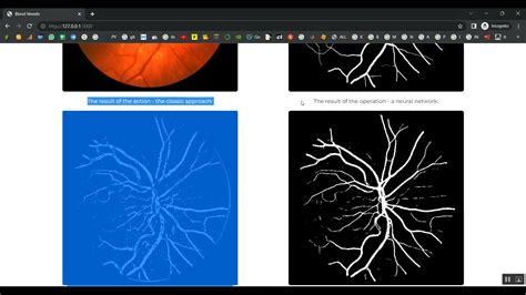 An Efficient And Light Weight Deep Learning Model For Accurate Retinal