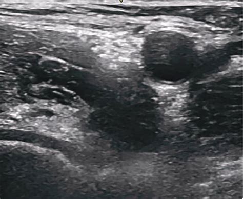 Femoral Diagram Quizlet