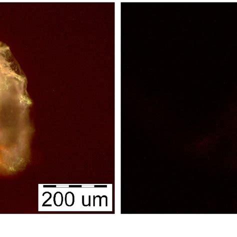 Cross Section Of Pseudocalanus Spp Gut Area With Digested Dyed Pvc