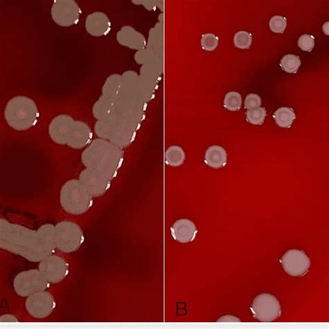 Target Shaped T1 Colony Morphology A In A Mrsa Isolate B In A