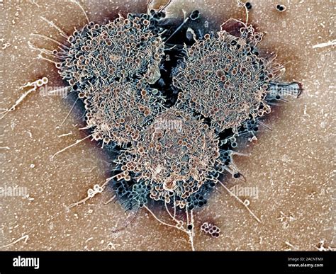 Staphylococcus Aureus Bacteria Coloured Scanning Electron Micrograph SEM Of Staphylococcus