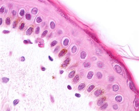 Tecido Epitelial Características Funções E Classificações