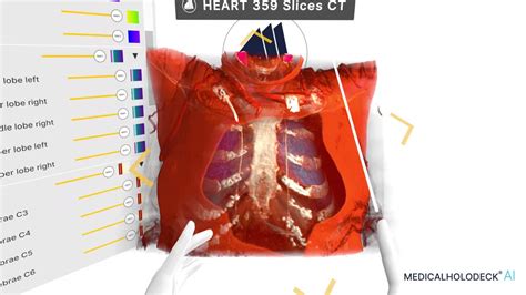 Kurt Ruffieux On Linkedin Fantastic New Tools For Surgeons