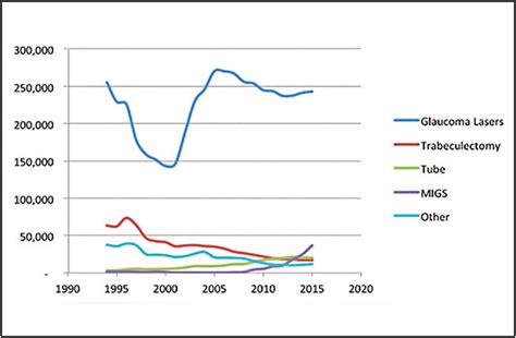 Coding For Minimally Invasive Glaucoma Surgery Ophthalmology Management