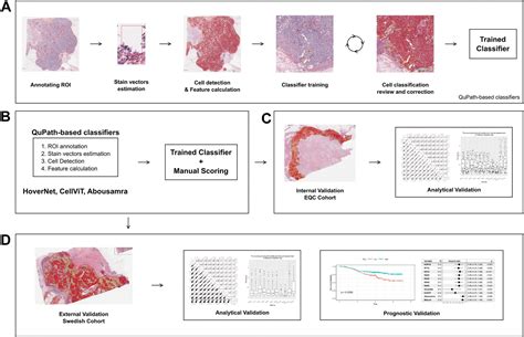 Ai Models Redefine Til Scoring In Breast Cancer But Face Challenges In Real World Validation