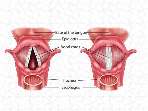 Larynx