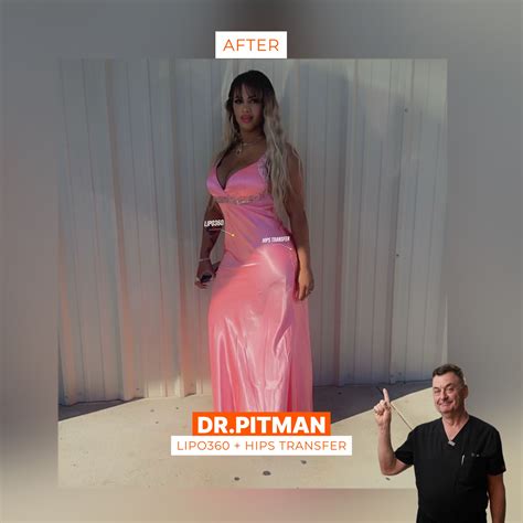 Smart Plastic Surgery Miami Fl