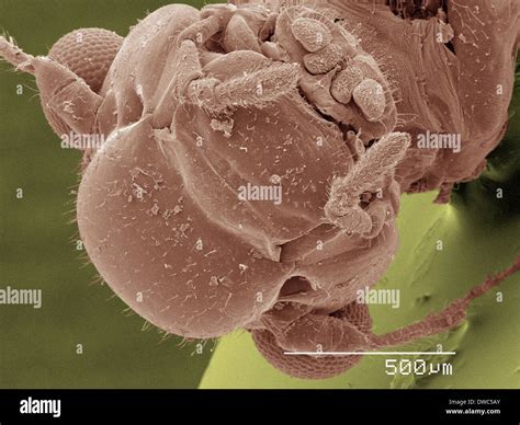 Head Louse Microscope Fotos Und Bildmaterial In Hoher Auflösung Alamy
