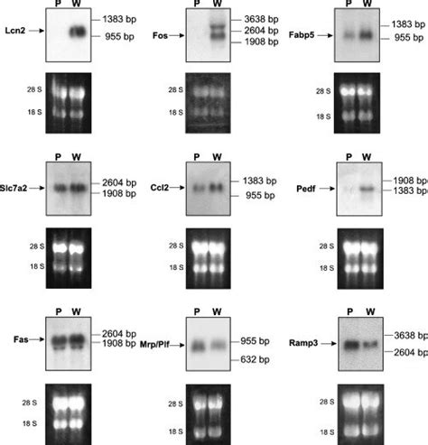 Northern Blot Analysis Of Expression Of Candidate Target Genes In