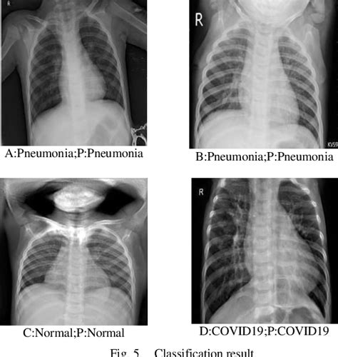 Figure 5 From Disease Aware Chest X Ray Style Gan Image Generation And Catboost Gradient Boosted