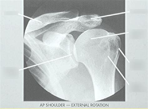 External Rotation Anatomy Diagram Quizlet