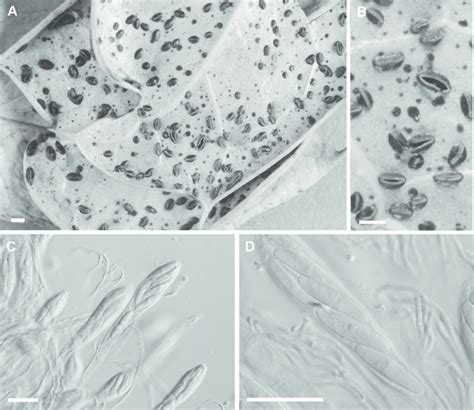 Hypoderma Brachysporum Ab Ascomata On Leaves Pdd 89896 C Asci