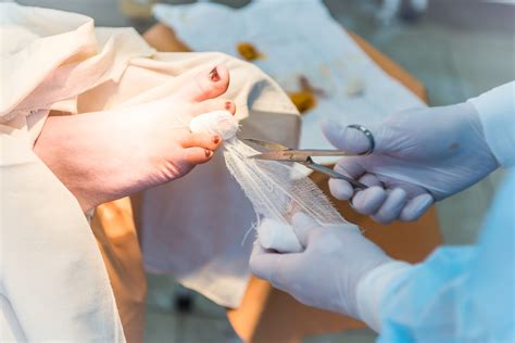 Toe Shortening Surgery In Atlanta Best Clinics And Overview