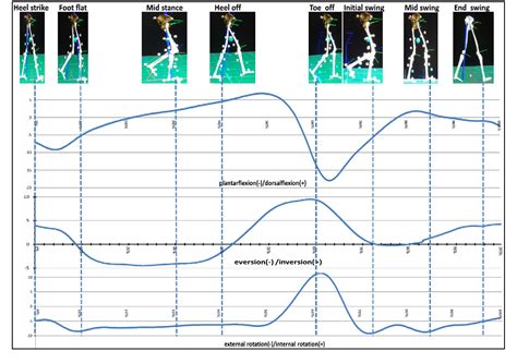 Figure 1 From Three Dimensional Ankle Kinematics Of The Full Gait Cycle In Patients With Chronic