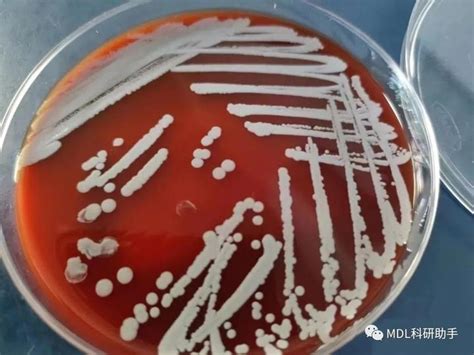 贴壁细胞培养，细胞不贴壁怎么办？ 知乎