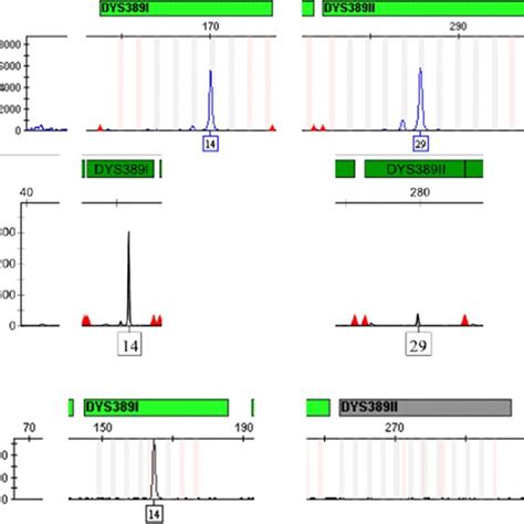 How Mutation At Pcr Primer Binding Sites Gives Rise To Different Pcr Download Scientific