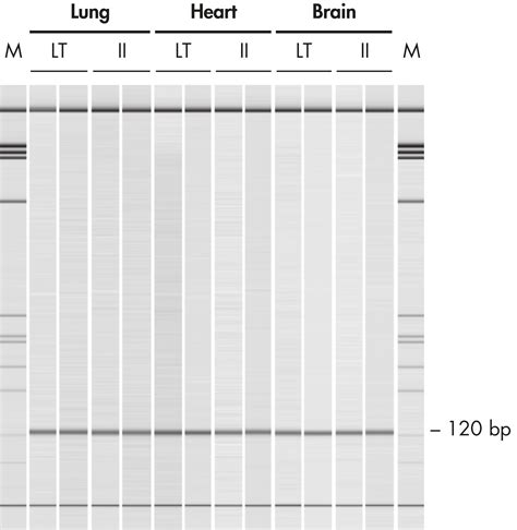 Tissuelyser Ltqiagen优宁维univ商城