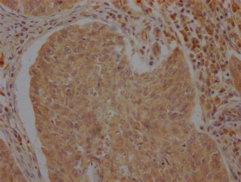 Atf6 Polyclonal Antibody Invitrogen 100 μl Unconjugatedantibodies