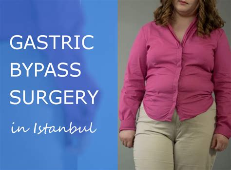 Gastric Bypass In Istanbul In Turkey Weight Loss Surgery