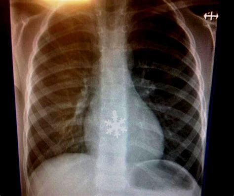 Рентгенівські знімки які здивували лікарів вражаючі фото Ідеї