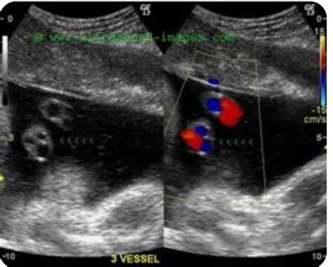 Эмэгтэйчүүдийн эмнэлэг Цогнэмэх ХҮЙН СУДАС ГЭЖ ЮУ ВЭ 👩‍⚕️Хүүхэд төрөхдөө ээжтэйгээ хүйгээр