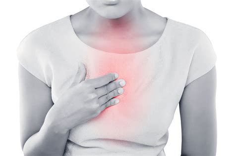 Esofagitis Erosiva Qué Es Clasificación De Los Ángeles Y Tratamiento