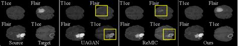 Figure From Learning Multi Modal Brain Tumor Segmentation From Privileged Semi Paired MRI