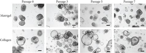 Comparison Of Growing Human Derived Colon Organoids In Matrigel And In Download Scientific