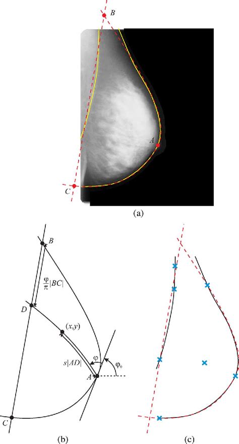 Figure 1 From An Anatomically Oriented Breast Coordinate System For