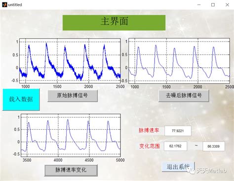 【信号处理】脉搏信号处理系统含matlab源码 哔哩哔哩