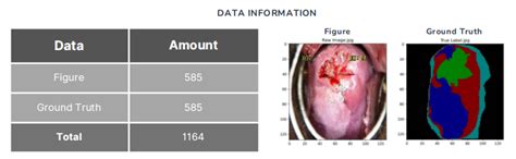 GitHub Ares0098 Multiclass Semantic Segmentation On Pre Cancer Cervical Image Using Deep