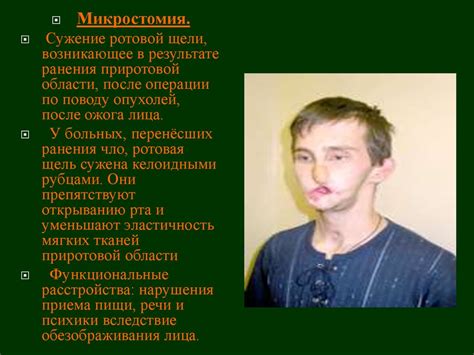 Функциональные нарушения при повреждении челюстно лицевой области Основы лечебной гимнастики