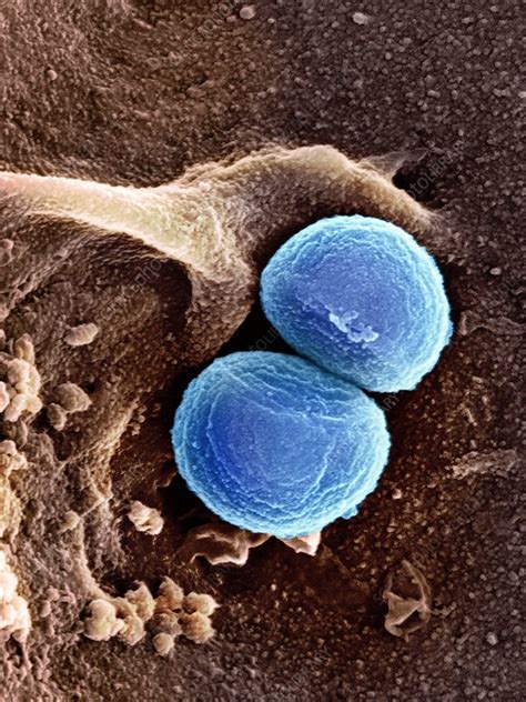 Staphylococcus Aureus Bacteria Sem Stock Image C006 6700 Science Photo Library
