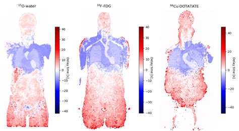 A Robust Method For Voxel Vise Total Body Estimation Of Tracer Arrival In A Long Axial Field Of