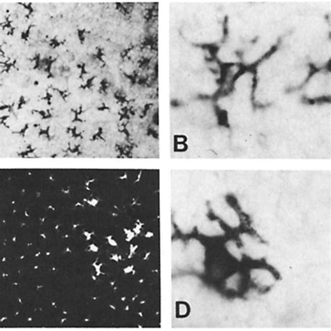 Immunolocalization Of Thy 1 And Ia In Murine Ear Epidermal Sheets A