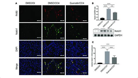 Quercetin Inhibited Hepatic Notch1 Expression In Ccl 4 Treated Mice Download Scientific