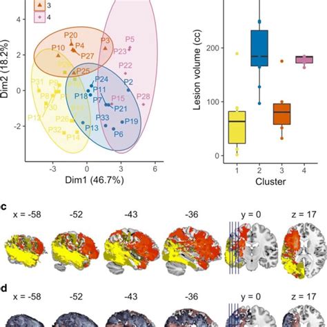 Gm Wm Clustering A Results Of The K Medoids Analysis Using Combined