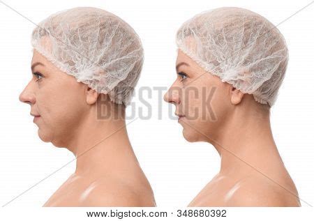 Mature Woman Before Image And Photo Free Trial Bigstock