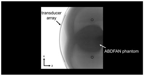X Ray Image Of The Flexible Array Transducer With The Abdfan Phantom Download Scientific Diagram