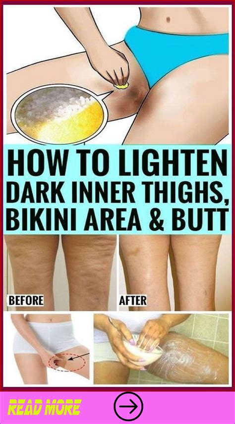 How To Lighten Dark Inner Thighs Naturally Artofit