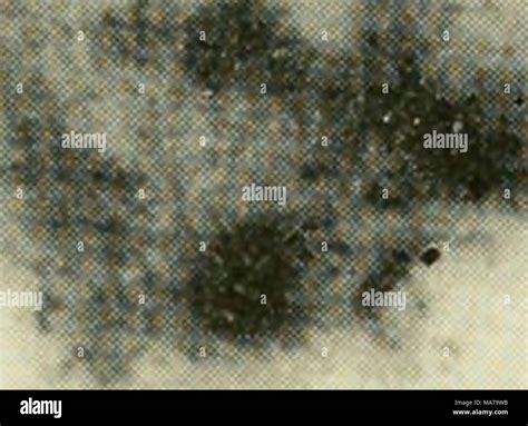 Electron Microscopic Structure Of Protozoa 4 â 25 Stock