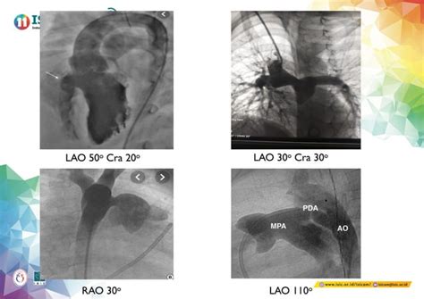 Lecture 10 Pediatric Cardiology Cath Labpdf
