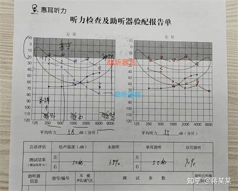 中度耳聋后隐形助听器的干预方案 知乎