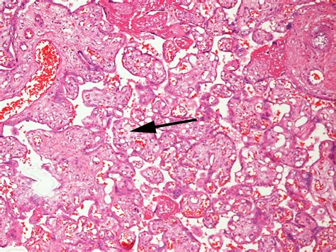 File Placenta Histology 005  Embryology
