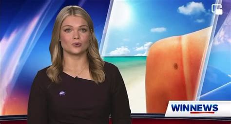 Spotchecks Australianskincancerfoundation Getaskincheck Molemap