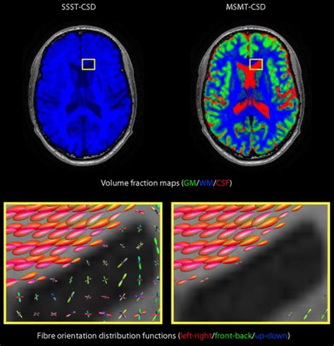 Figure 5 From Multi Tissue Constrained Spherical Deconvolution For