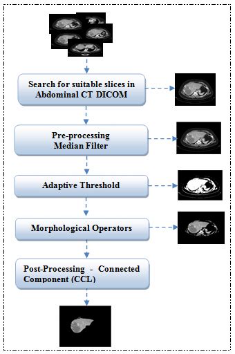 Architecture Of The Proposed Automatic Liver Segmentation System Download Scientific Diagram