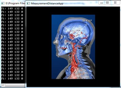 Vtk修炼之道75：交互部件测量类widget的应用vtkbidimensionalwidget Csdn博客